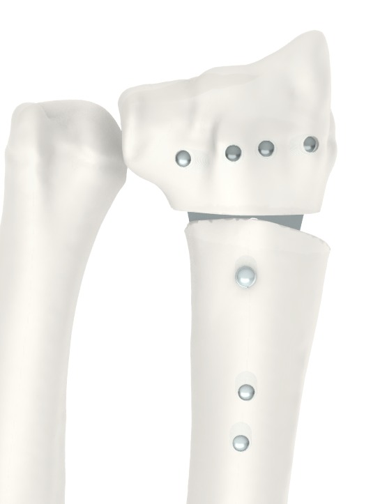 Python help - Scripting - McNeel Forum