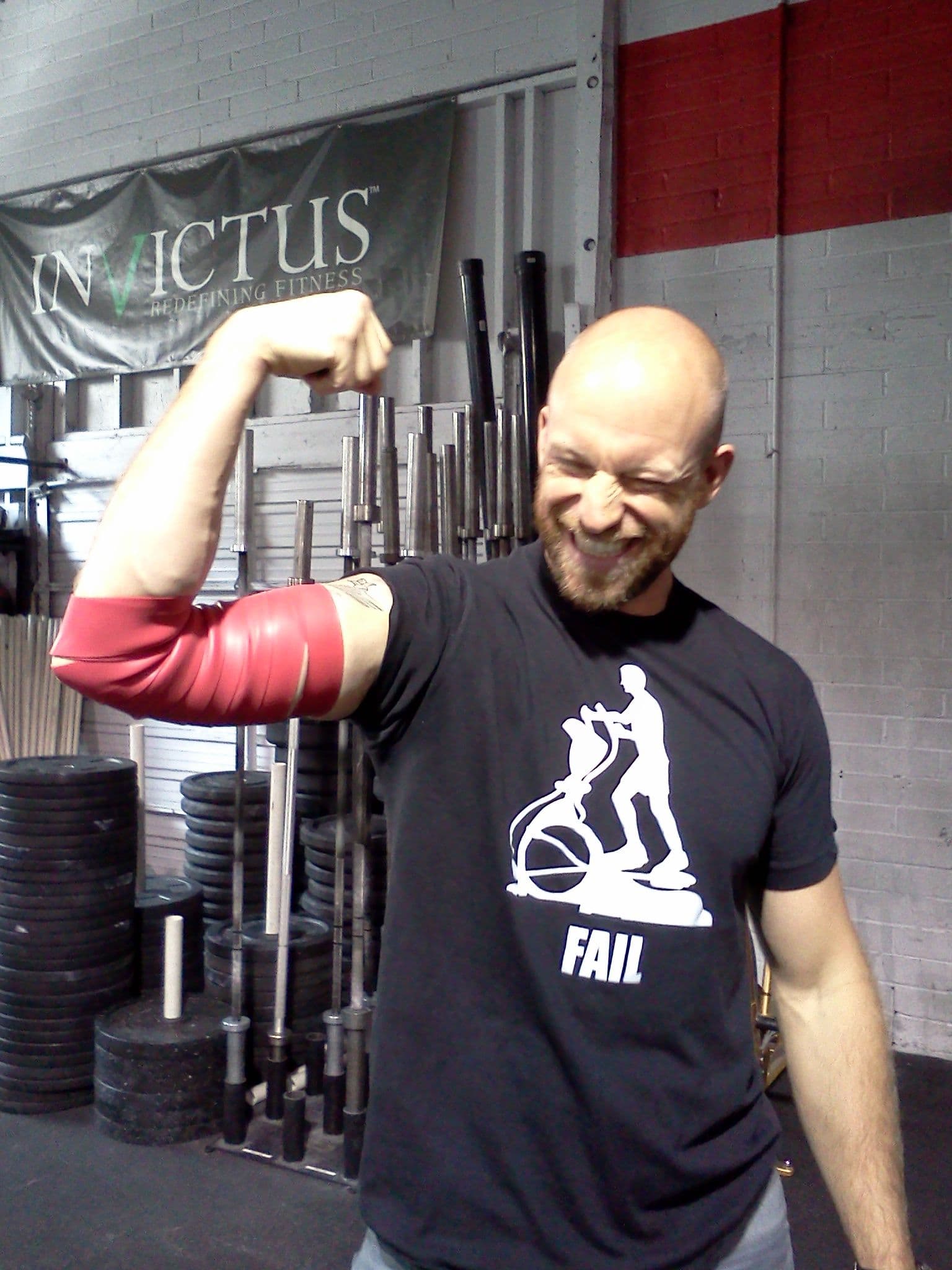 Triceps Pain from Pull-Ups?! - Injuries and Rehab - T NATION