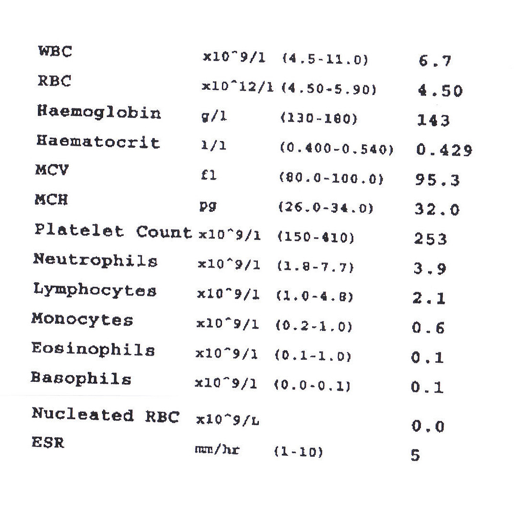 Low Normal Test, Low FSH, LH, & High TSH - Testosterone Replacement - T ...