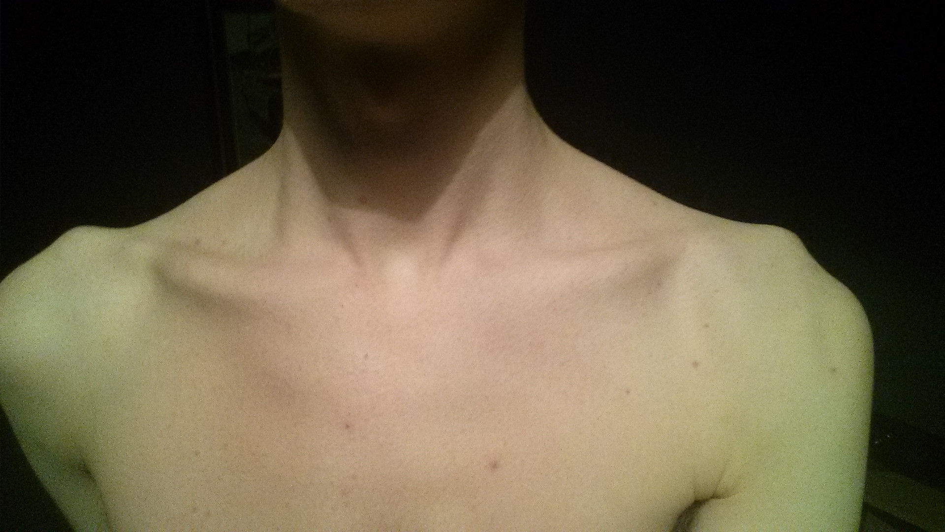 Big Protruding Clavicles - Page 7 - Bigger Stronger Leaner - T NATION