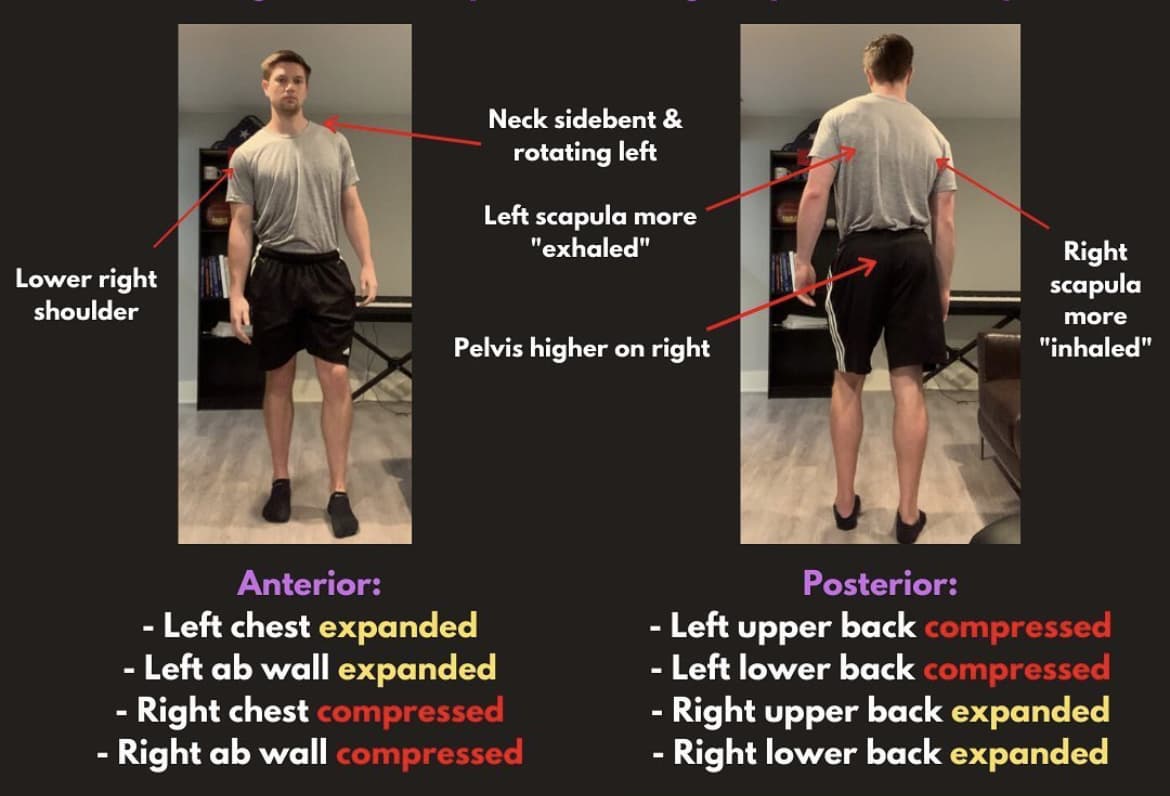 Fixing Shoulder Issues. Rounded Forward, Imbalances? - Injuries and ...