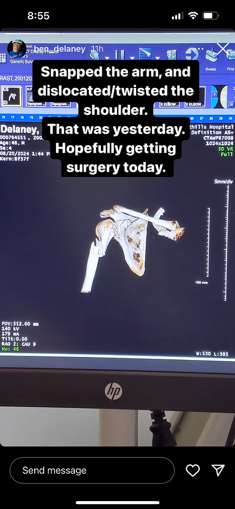 Sending Ben Delaney some positive vibes - TrainerRoad