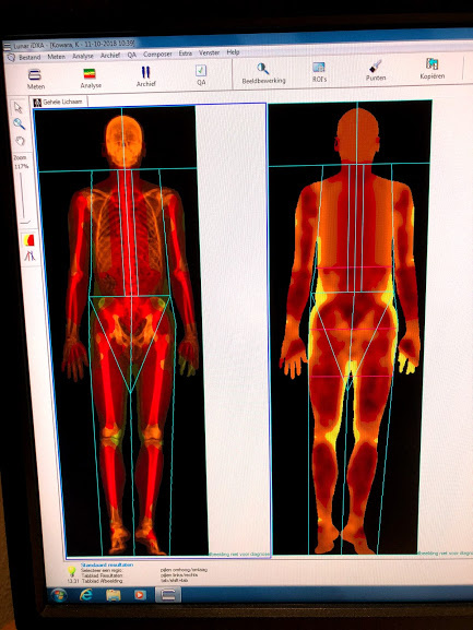 Dexa Scans! At home scales, my results and reference pics - Page 4 ...