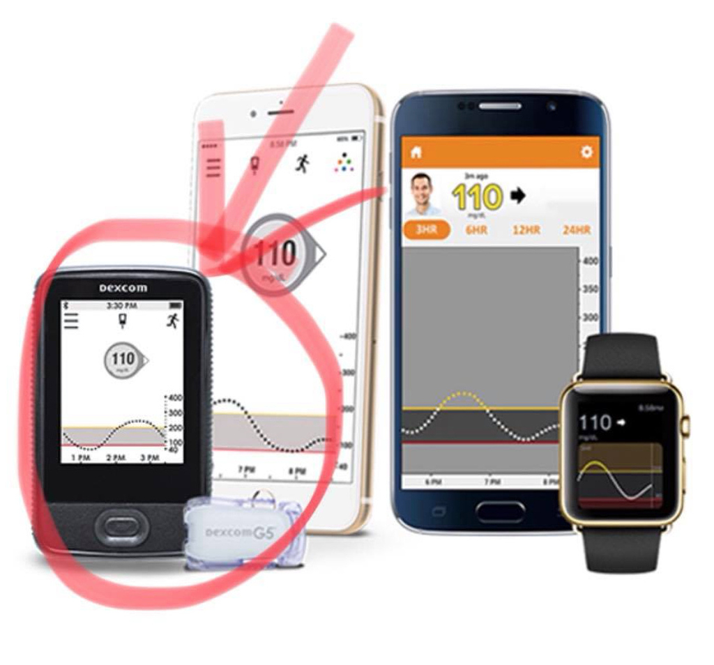 New Dexcom G5 Mobile Receiver? - Glucose Monitoring - TuDiabetes Forum