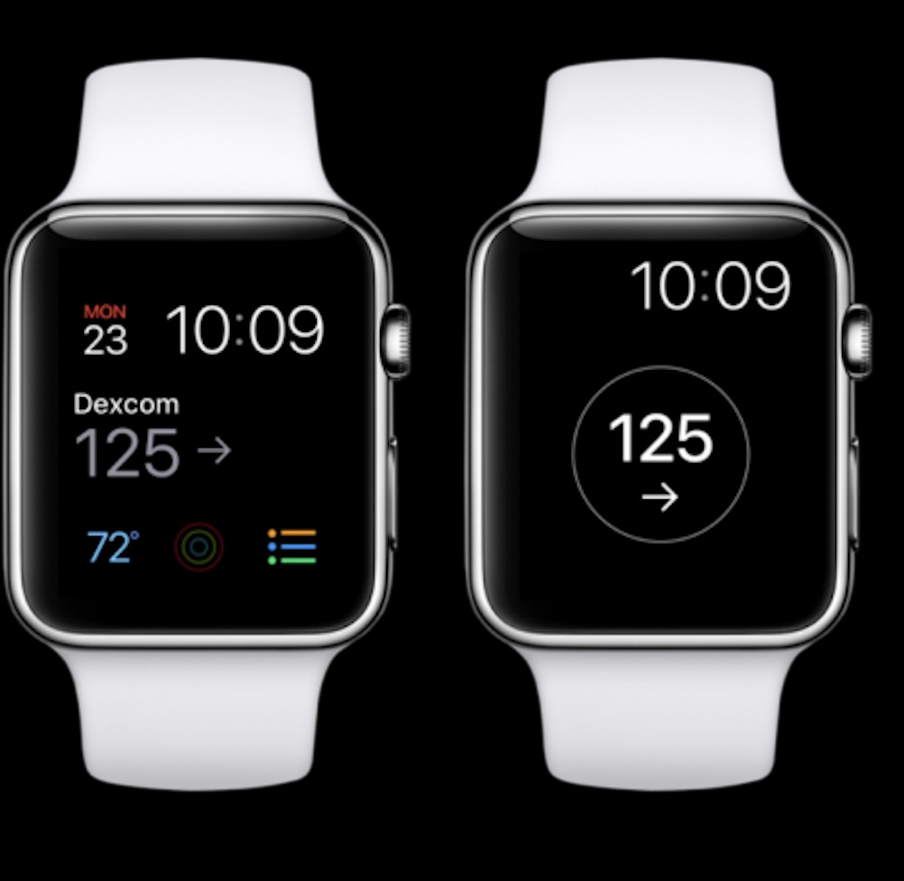 Apple Watch Face For Dexcom With Large Digits Diabetes Technology